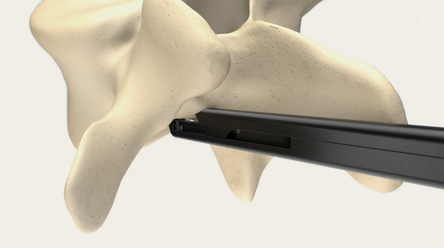 SQ.line® KERRISON Bone Punches